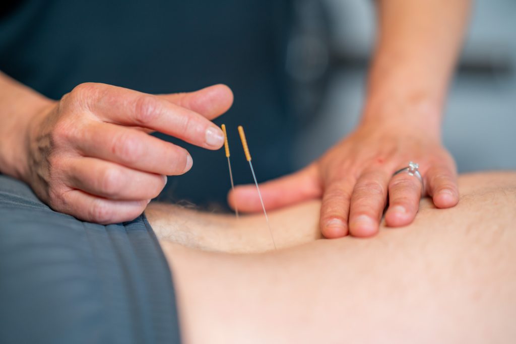 Dry Needling – Integrated Health Center LLC